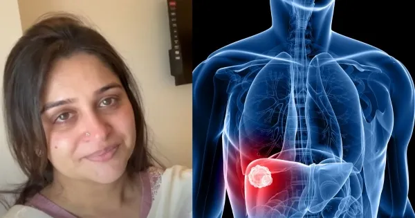 kansar - Tarun Mitra